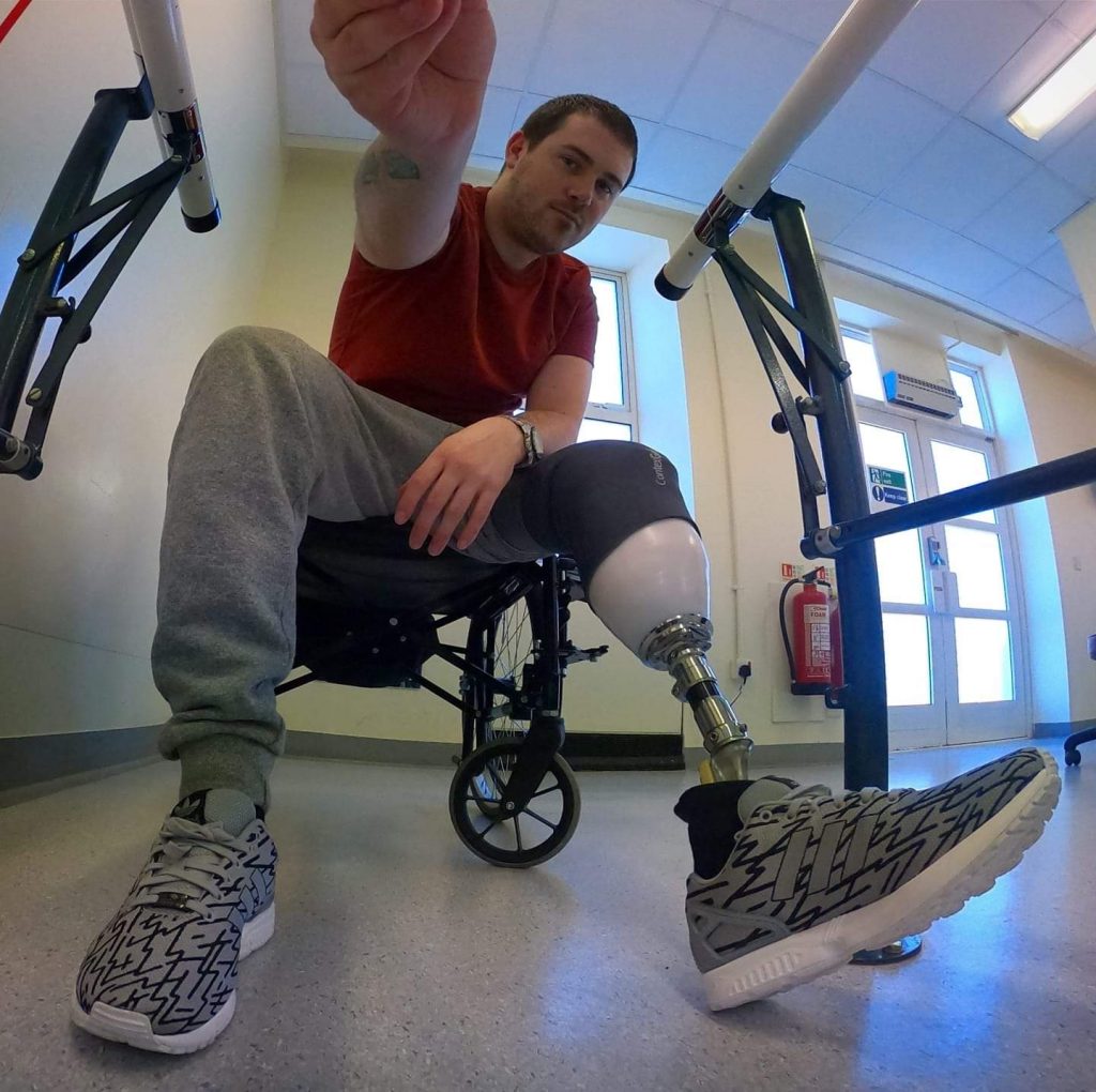 #15 - My first prosthetic leg - The Furthest Point